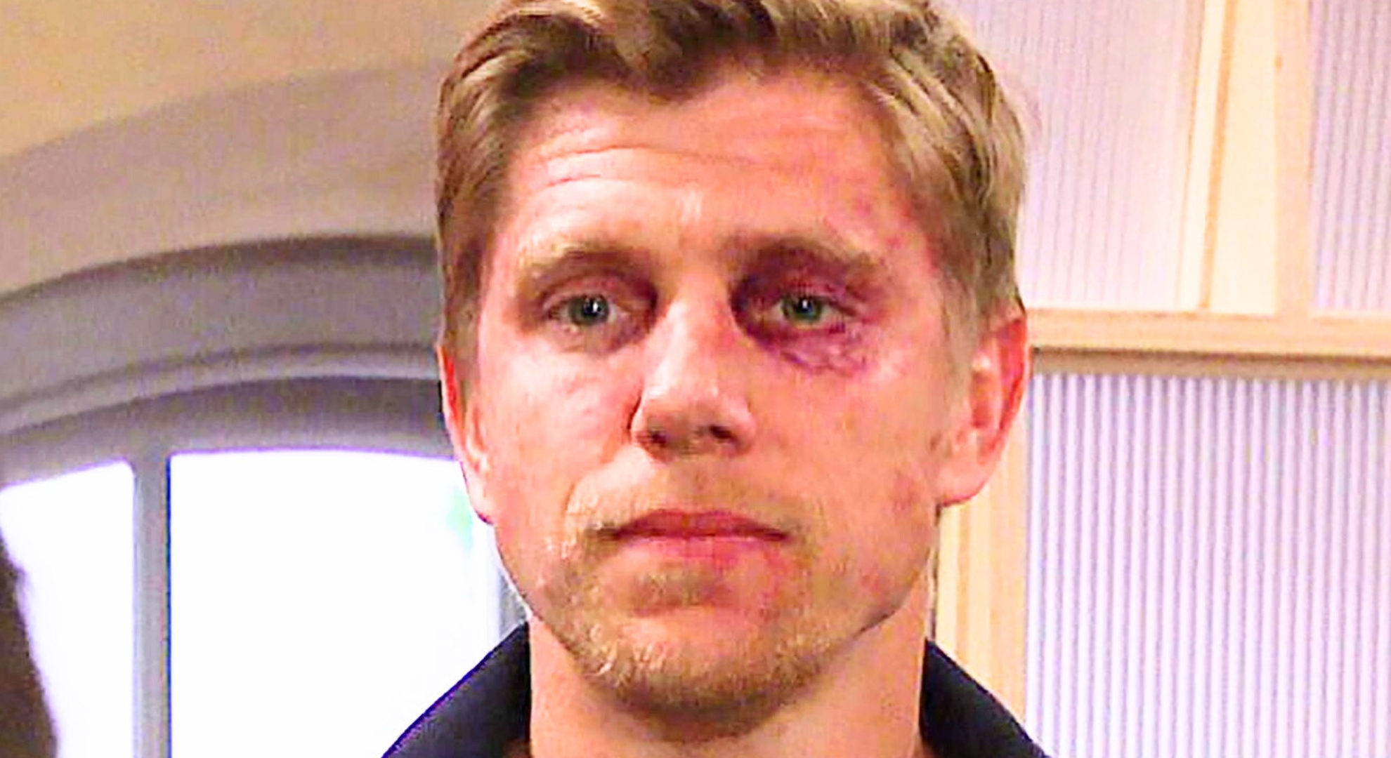 Spoilers reveal the exact date Robert Sugden returns to Emmerdale ‘for ...